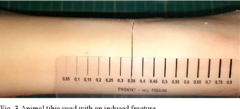Figure 3 From Experimental Evaluation Of Thin Bone Fracture Detection Using Microwave Imaging