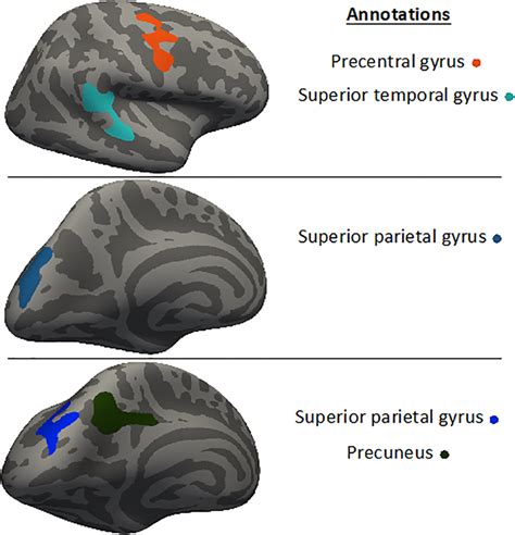 Visualization Of Brain‐clusters With Identified Between‐group