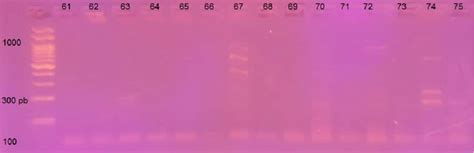 Agarose Gel Electrophoresis Image Show The Pcr Product Analysis Of 18s