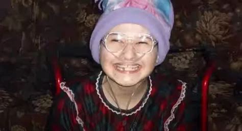 Gypsy Rose Battled Munchausen Syndrome By Proxy Expert Reveals Hard