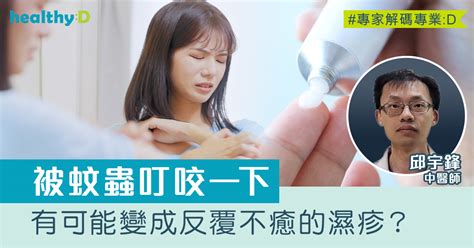 蚊叮蟲咬｜引起皮膚紅疹痕癢 有可能演變成慢性濕疹！中醫拆解原因、高危一族及治療方法 註冊中醫師邱宇鋒