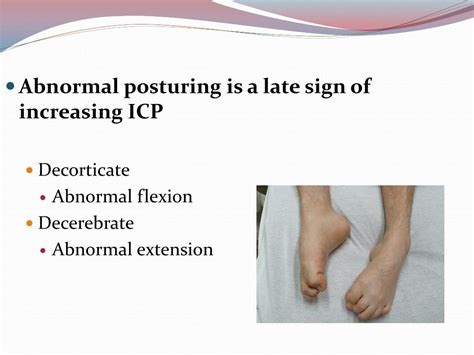 Ppt Neurology Powerpoint Presentation Free Download Id 1935744