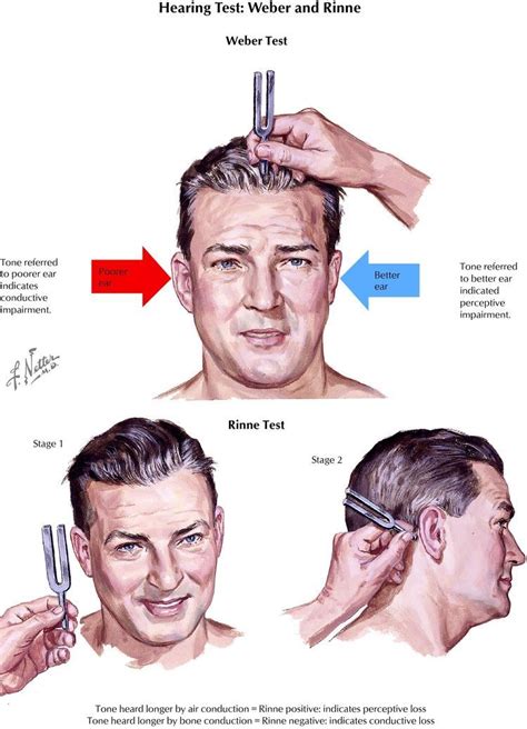 Rinne And Weber Test