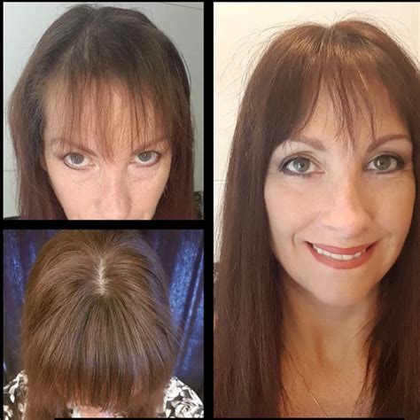 Thinning Hair Women Fashionnfreak