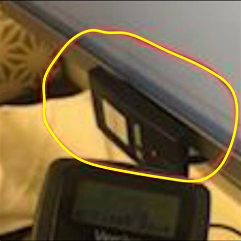 Overview Of Open Loop DBS A Versus Closed Loop DBS B In Open Loop Download Scientific