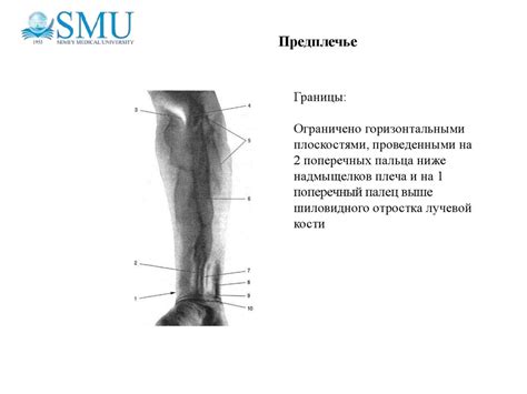 Топографическая анатомия верхних конечностей презентация онлайн
