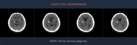 Ai In Radiology 10 Use Cases Benefits And Examples