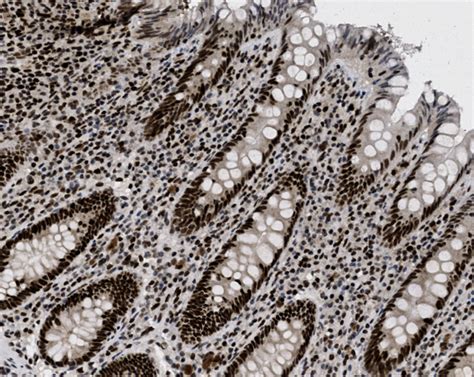 Tissue Tek Genie Rapid True Random Access Ihc Staining
