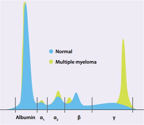 Making Sense Of Serum Protein Bands Best Tests July 2011