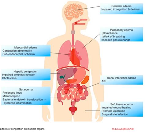 The Realm Of Tissue Perfusion Systemic Hypoperfusion And Congestion
