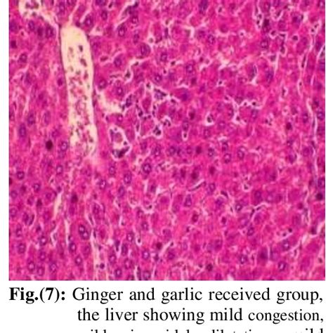 Ginger Received Group The Liver Showing Sinusoidal Cell Dilatation And