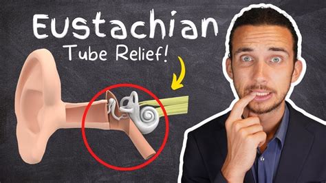 Eustachian Tube Dysfunction