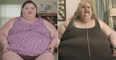 How 1000 Lb Sisters Amy And Tammy Lost Weight Risky Surgery To