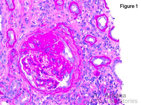 Hivick And Hiv Teaching Point Arkana Laboratories