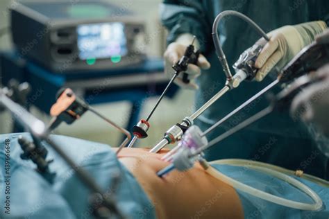 Foto De Laparascopic Surgery Do Stock Adobe Stock