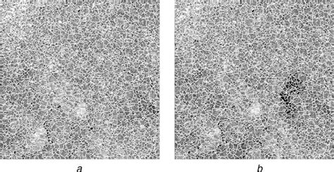 superpixels of the ier a forward phase b post phase download scientific diagram