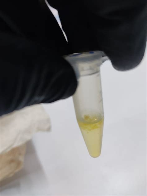 What Is The Best Way To Precipitate Protein After Ultracentrifugation