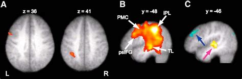 Figure 1 From Modulation Of Inferotemporal Cortex Activation During