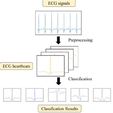 Main Procedures Of Ecg Heartbeats Classification Download Scientific