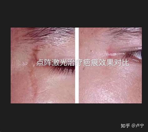 国内修复疤痕最好医院是哪几家？ 知乎