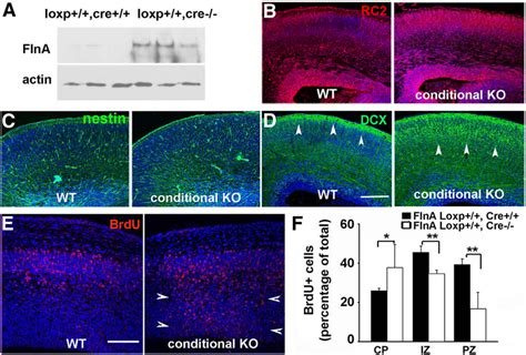 Neuronal Migration Defect Following Acute Loss Of Flna Function A