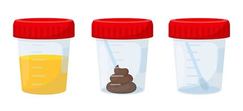 대변과 소변의 분석 흰색 배경에 격리 된 플라스틱 용기 만화 스타일의 벡터 일러스트레이션 소변 샘플에 대한 스톡 벡터 아트 및 기타 이미지 Istock