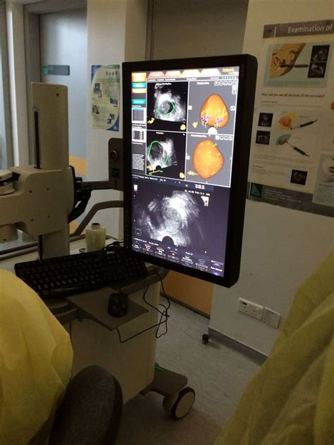 Semi Robotic System Of Mri Ultrasound Fusion Prostate Biopsy Agwaad