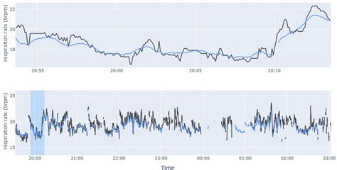 Respiratory Rate Estimates Of A Participant From Study Top Download Scientific Diagram