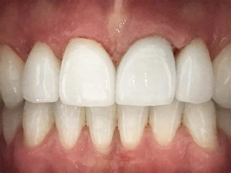 Gallery Murdoch Dental And Implant Centre