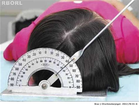 Cochlear Implant Radiography Technique Adapted Into A Portable