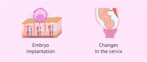 Can You Get Your Period While Pregnant Bleeding During Pregnancy