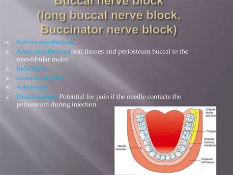 Mandibular Injection Techniques Pptx Ear Nose And Throat Conditions Diseases And Conditions