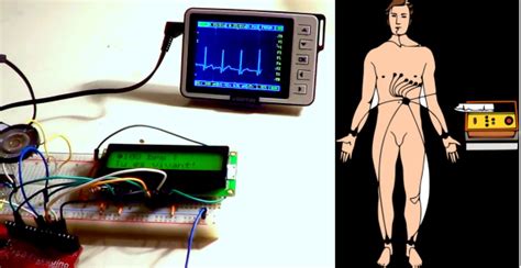 Arduino Powered Ecg Informs Users Of Their Death Hackaday