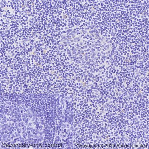 Biotin Anti Apolipoprotein E 抗体 [ep1373y] Ab323532 Abcam