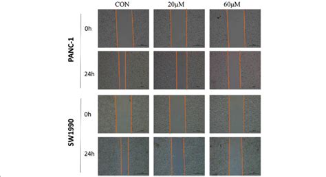 Betulinic Acid Inhibits Panc 1 And Sw1990 Cells Migration Wound