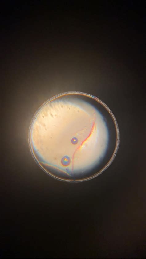 I Found These In My Urine What Are They The Blobs And The Hair Things R Biology