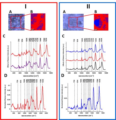 Raman Image And Spectral Analysis Of Human Gastric Cancerous Tissue I