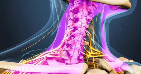 Anterior Cervical Discectomy And Fusion Acdf Video