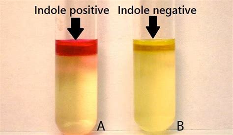Indole Test Introduction Principle Reagents Protocol Chemistry Notes