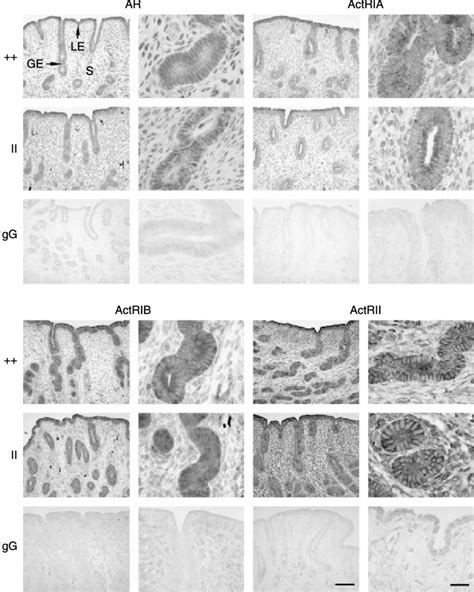 Immunohistochemical Localization Of Androgen Receptor Ar And Activin