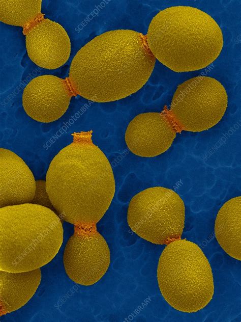 Fungus Rhodotorula Minuta Sem Stock Image C0322964 Science