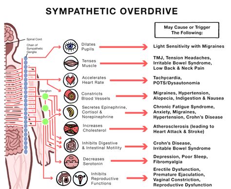 POTS Dysautonomia Treatment Program Treat Sympathetic Overdrive