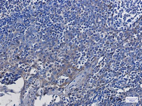 Eno1 Rabbit Mab 重组兔单抗兔单克隆抗体 α 烯醇化酶编码基因