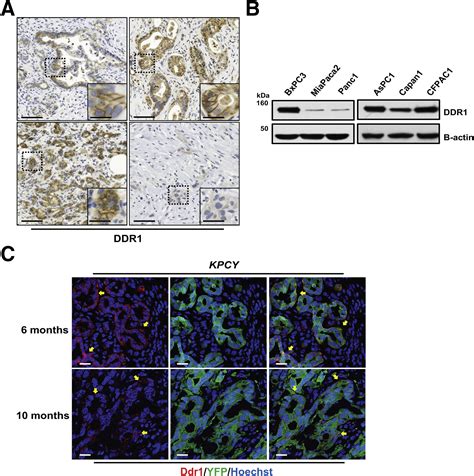 Discoidin Domain Receptor 1 Ddr1 Is Necessary For Tissue Homeostasis