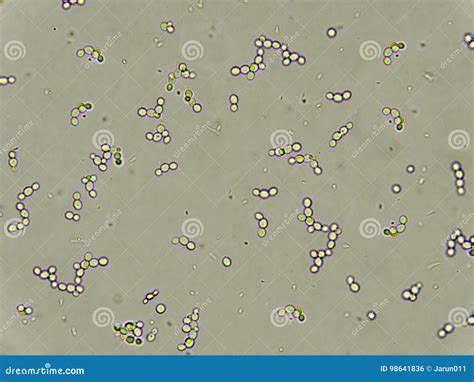 Budding Yeast Cells Under Microscope