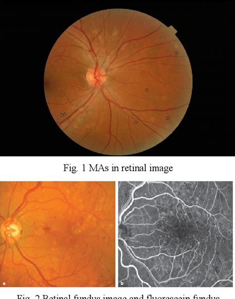 Figure 1 From An Improved Algorithm Based On Convolution Dynamic Multi Parameter Template For