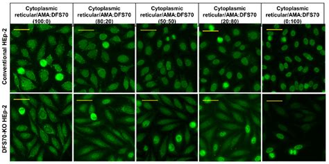 Simultaneous Distinction Of Monospecific And Mixed Dfs70 Patterns