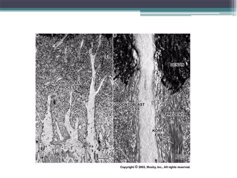 Histology Of Pulp Pptx Dental Health Diseases And Conditions