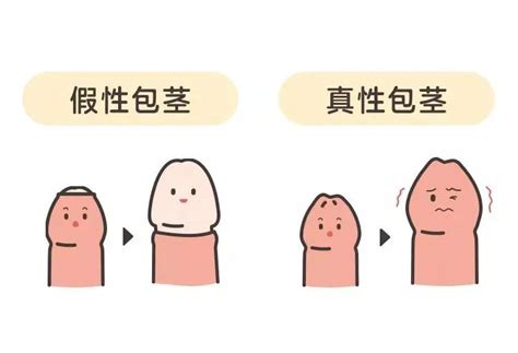 男宝私处说明书包皮蛋蛋小 JJ这些问题必须得知道 丁香医生