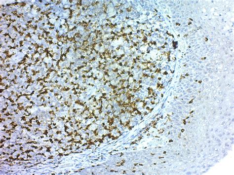 Rabbit Specific Hrp Dab Detection Ihc Detection Kit Ab236469 Abcam